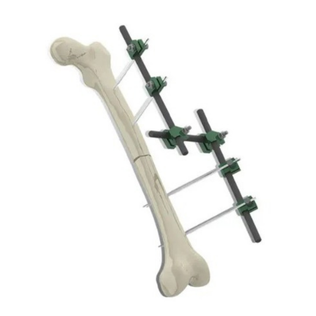 Fixador Tudo-Tubo – Medical Ortopedia